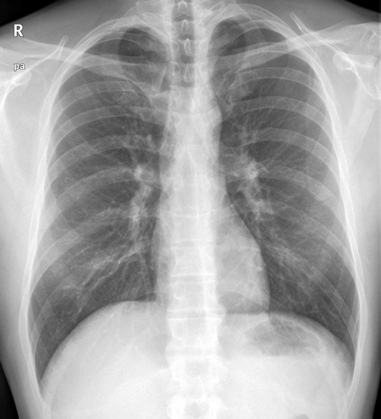 Röntgen: MR-CT-Karner